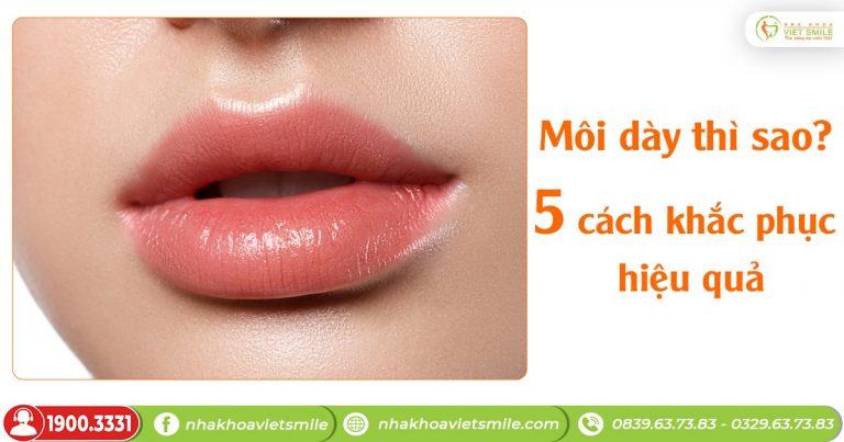 Môi dày thì sao? 5 cách khắc phục hiệu quả