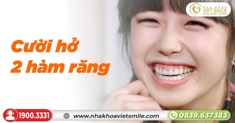 Cười hở 2 hàm răng